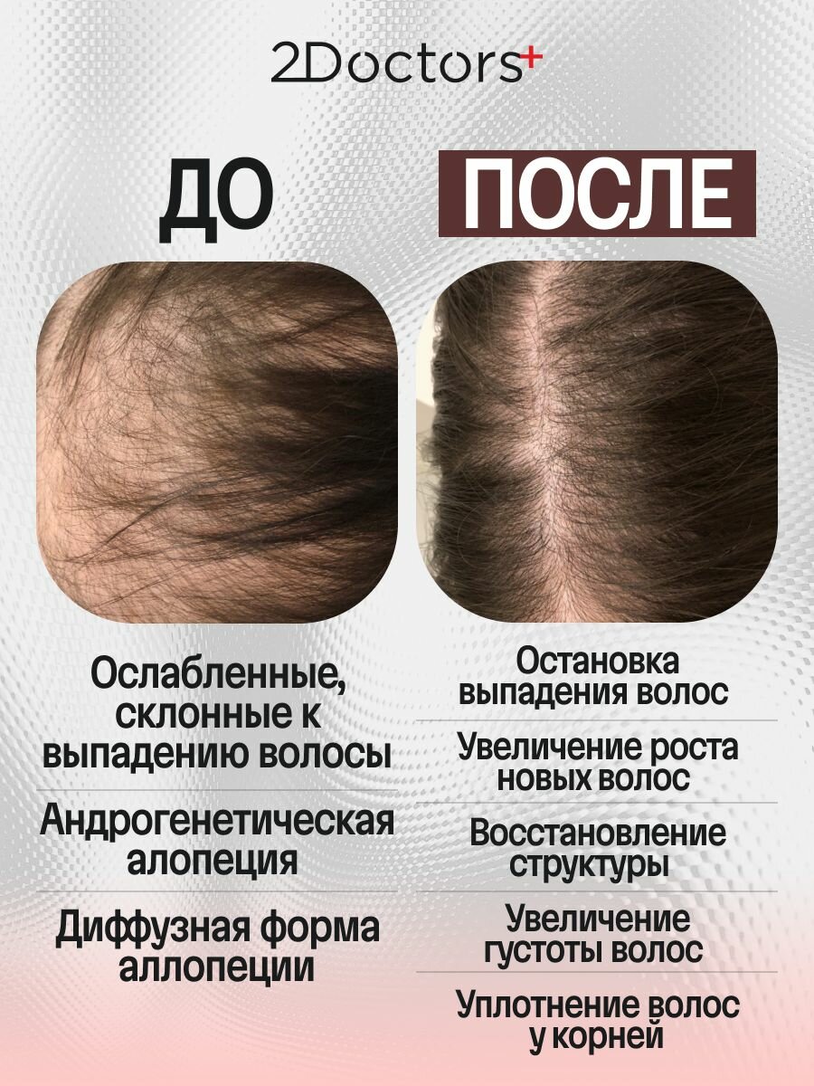 2Doctors Маска для волос, 245 мл — фото 1