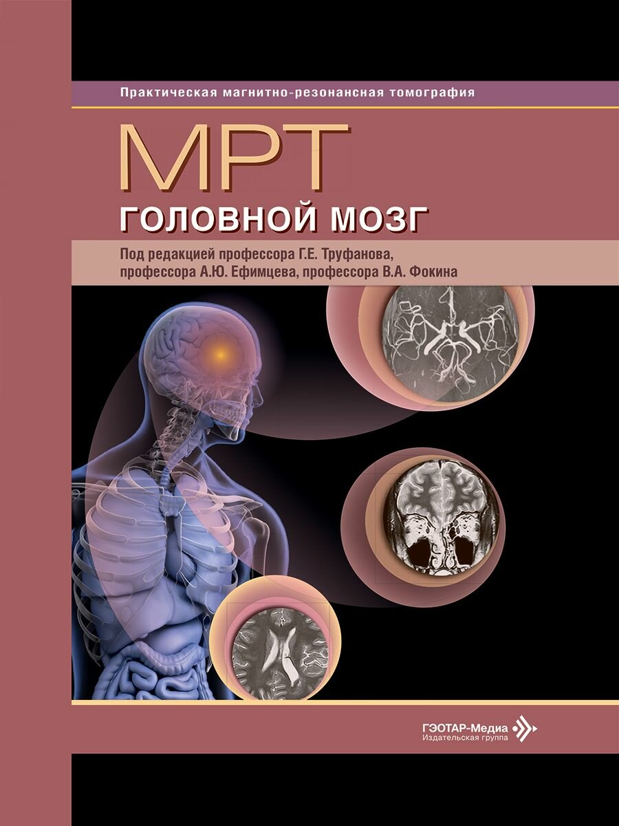 МРТ. Головной мозг: руководство для врачей