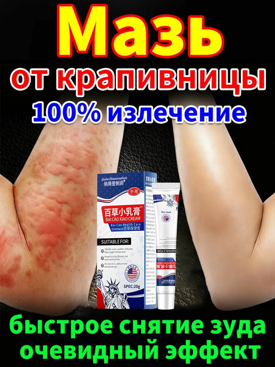 Мазь от крапивницы, Используется для лечения симптомов дерматита, крапивницы, экземы, зуда кожи, китайская чудо-мазь,20 г