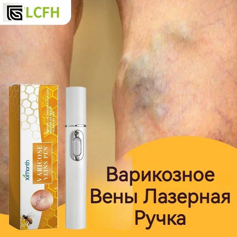 Лазерная ручка для лечения варикозного расширения вен, используемая для восстановления кровеносных сосудов в ногах, снимает отеки и боль, а также улучшает кровообращение