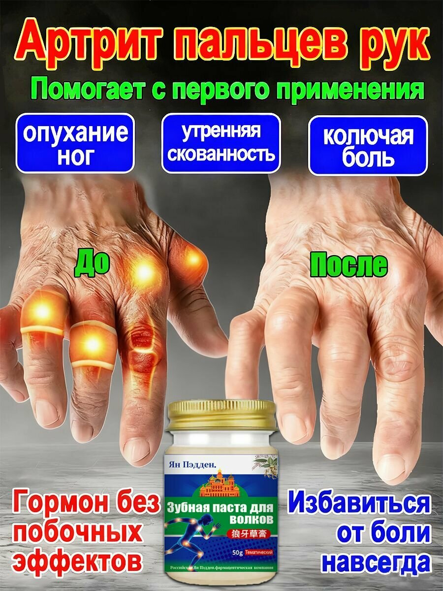 Обезболивающая мазь для суставов от боли крем