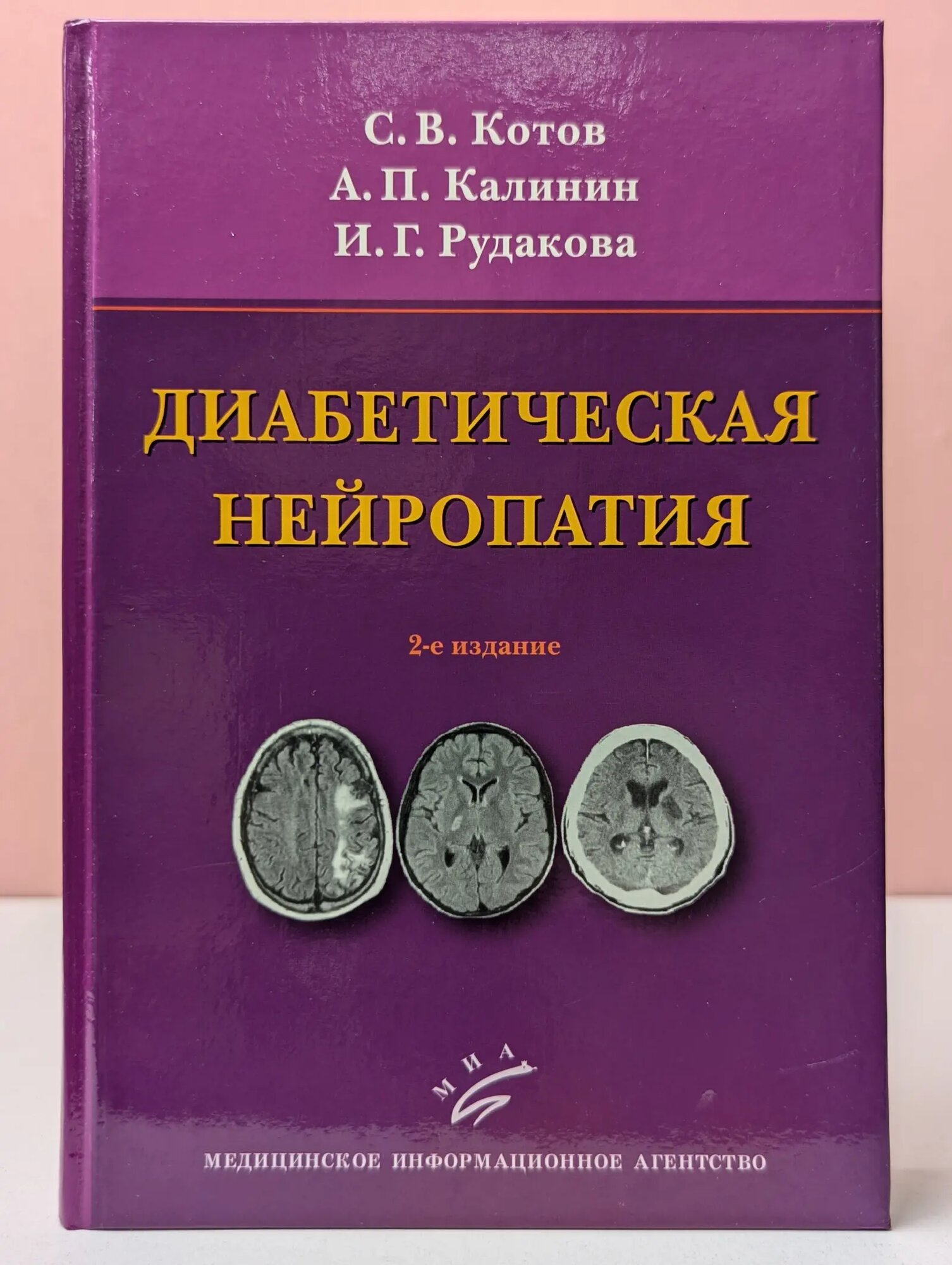 Диабетическая нейропатия Котов Сергей Викторович, Калинин Ариан Павлович, Рудакова Ирина Геннадьевна 2011
