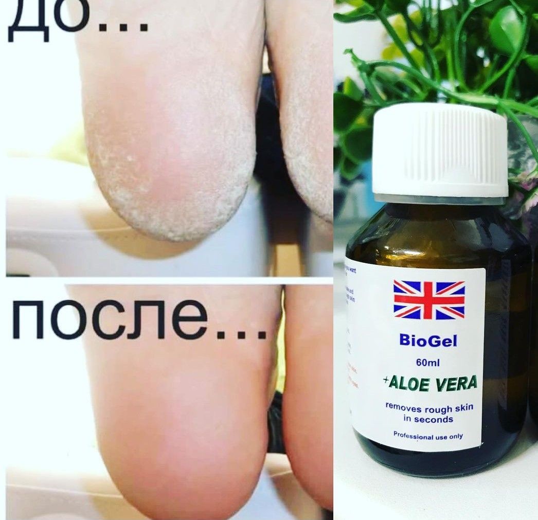 Биогель для педикюра с алое вера