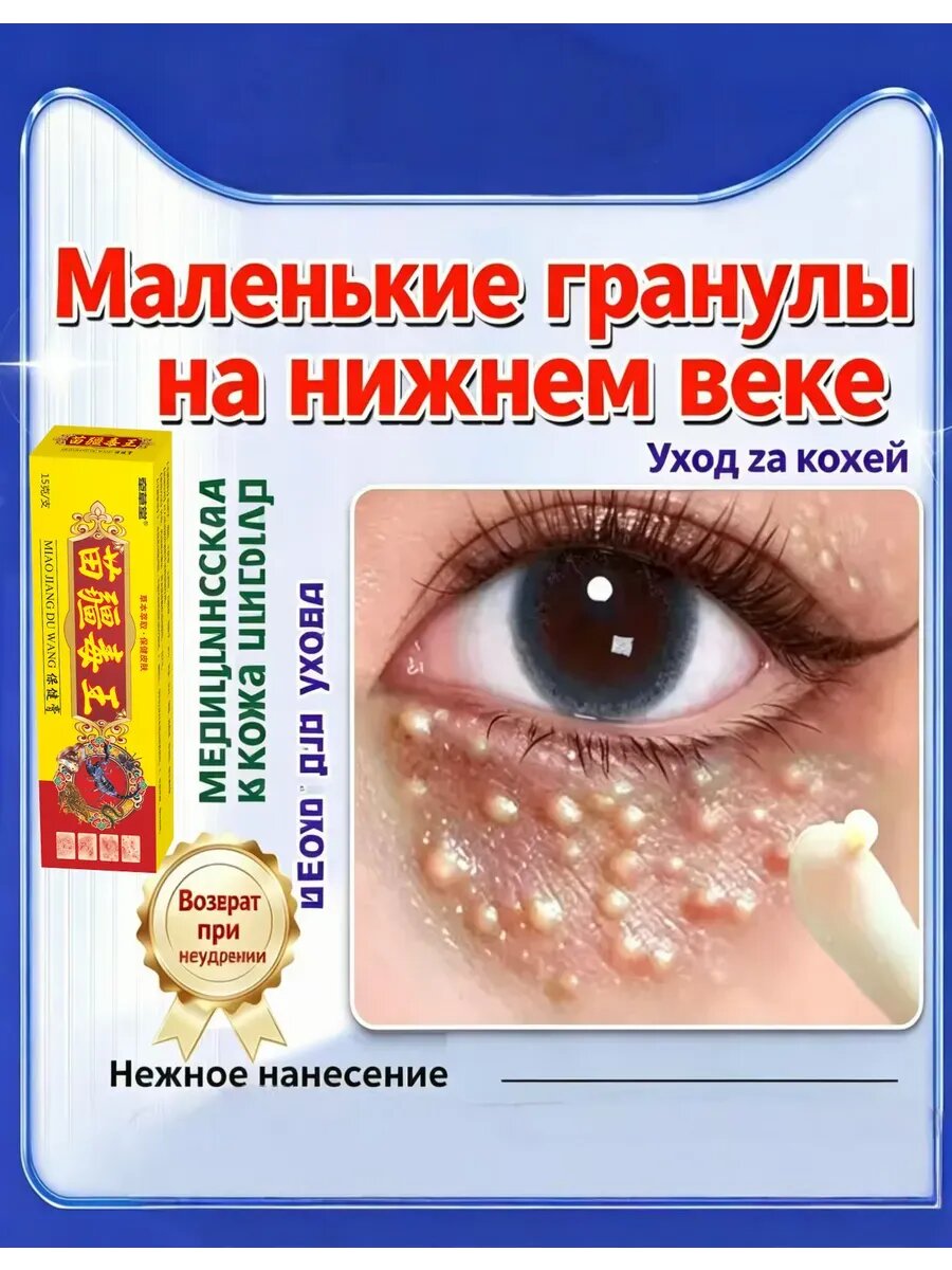 От жировиков на веках