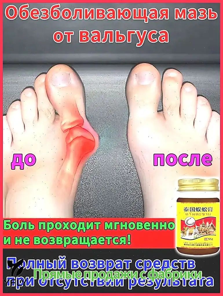 Китайская чудо мазь от вальгуса и косточки на ноге 55 г