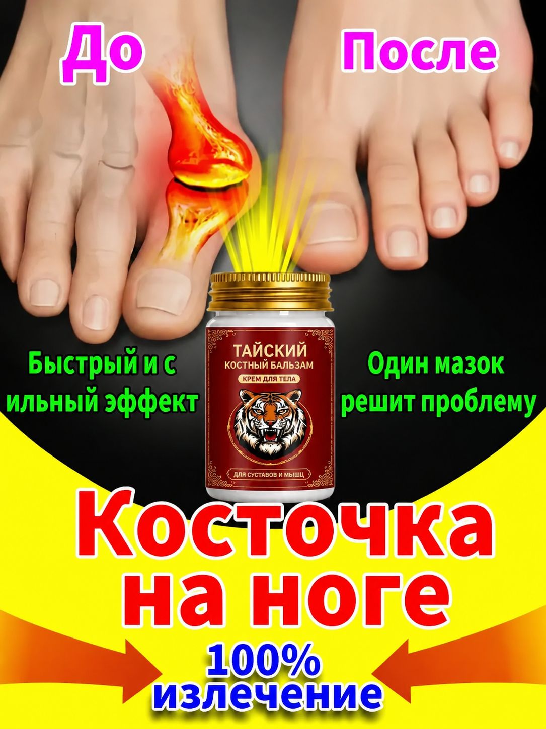 Мазь при вальгусной деформации косточки обезболивающая 50 г