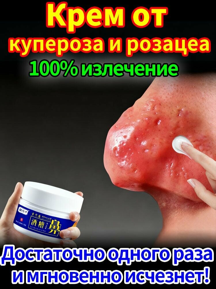 Мазь от розацеа и купероза, уменьшает покраснение и воспаление на лице, 30 г