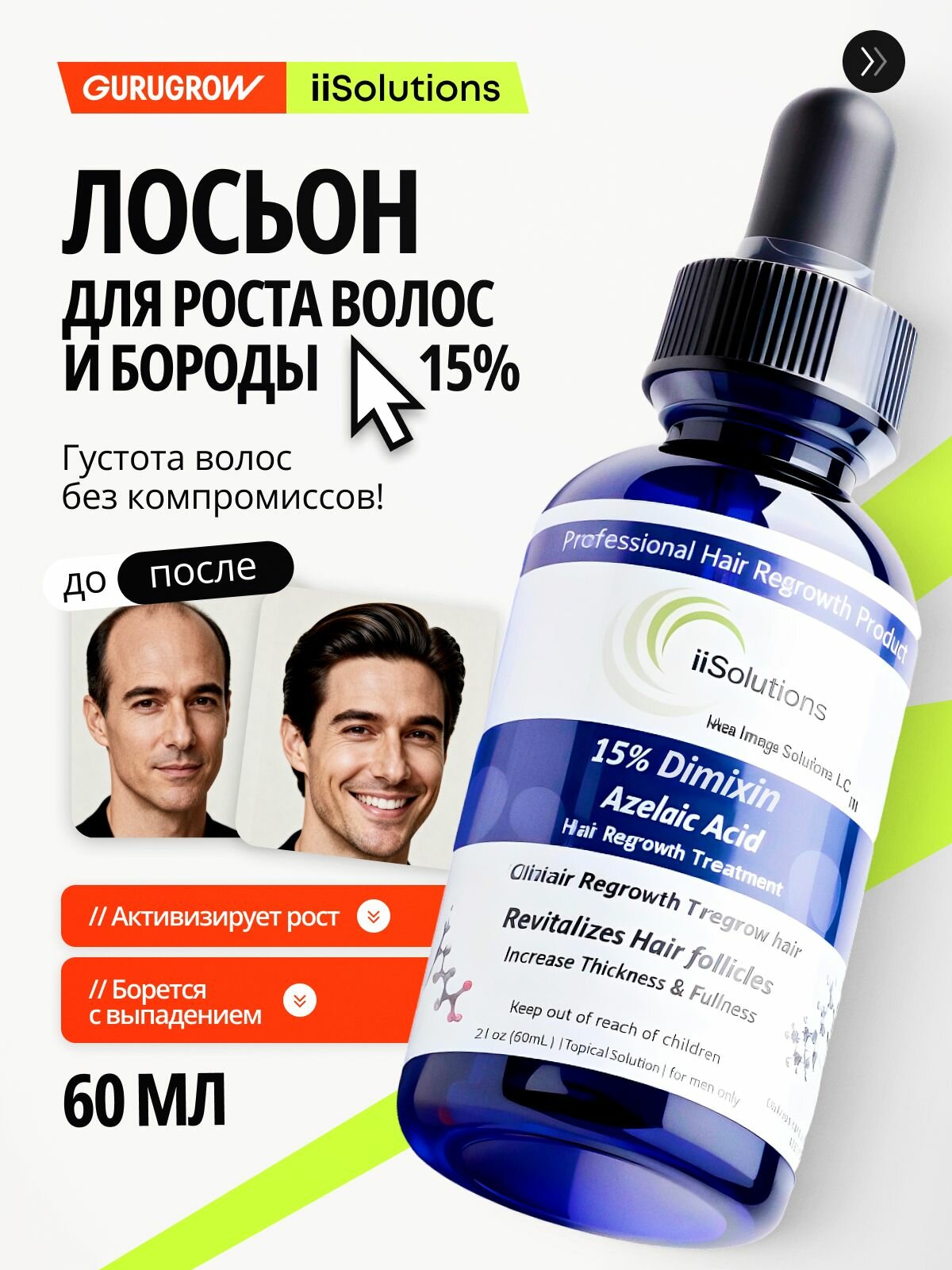 15% лосьон для роста волос и бороды, 60 мл