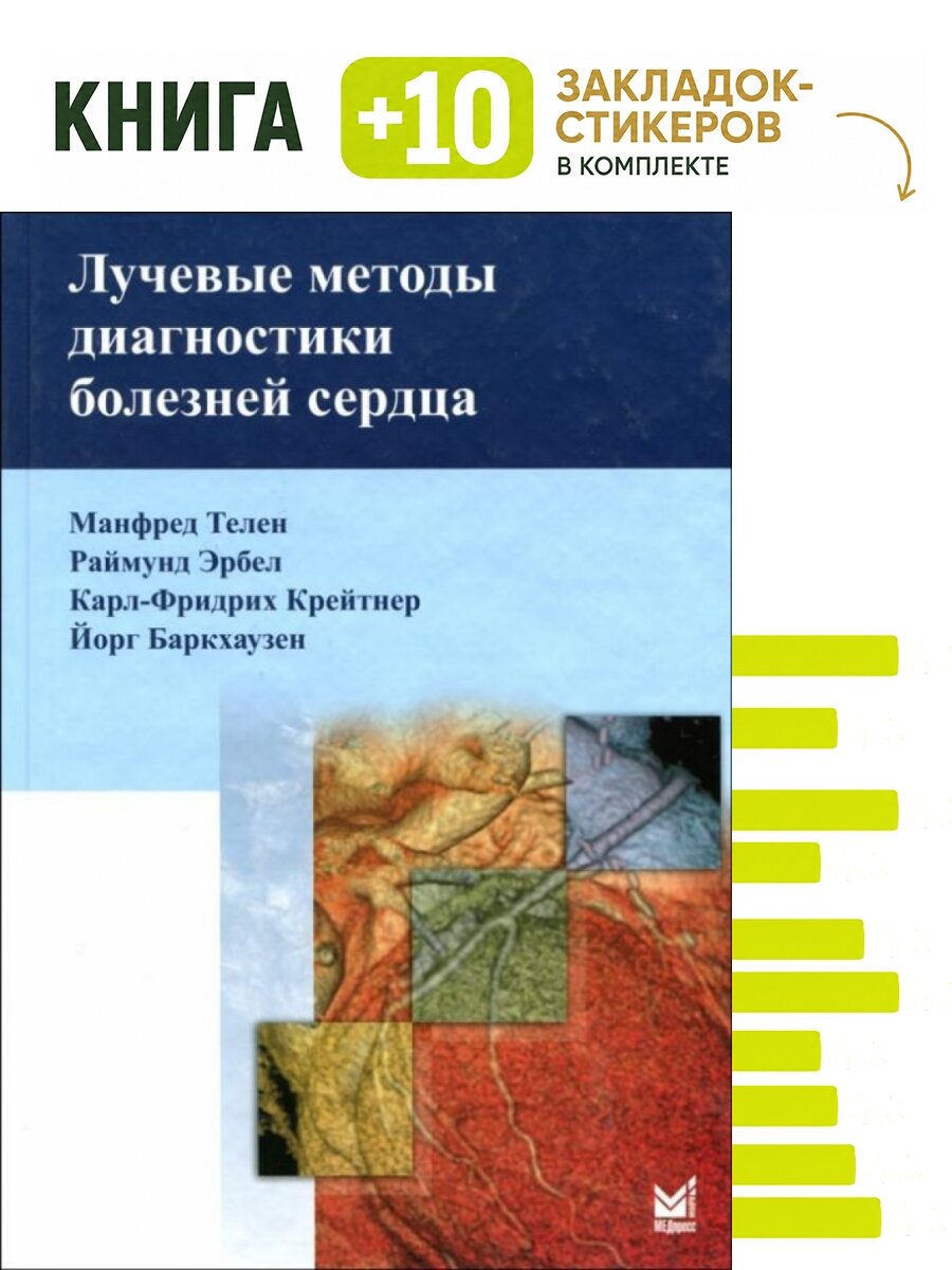 Лучевые методы диагностики болезней сердца. Комплект: книга + 10 закладок-стикеров
