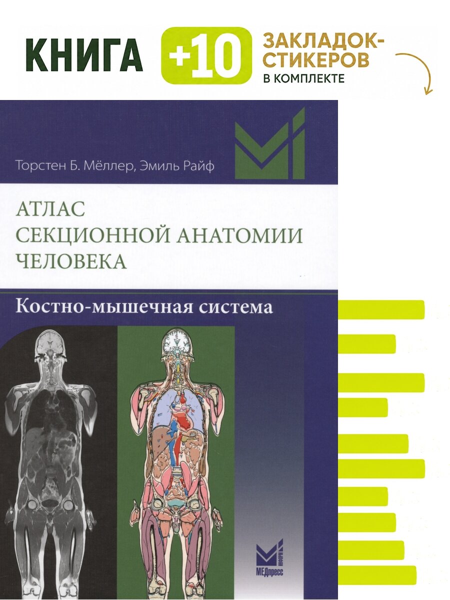 Атлас секционной анатомии человека. Костно-мышечная система. Комплект: книга + 10 закладок-стикеров