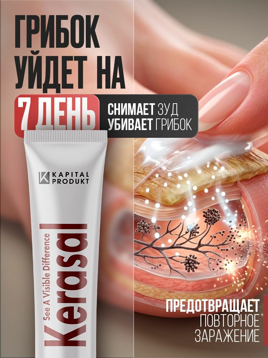 Противогрибковый крем KERASAL / Крем от грибка ногтей на ногах, от трещин, для пяток и стоп, мазь от псориаза, зуда, экземы и микозе / 30 мл