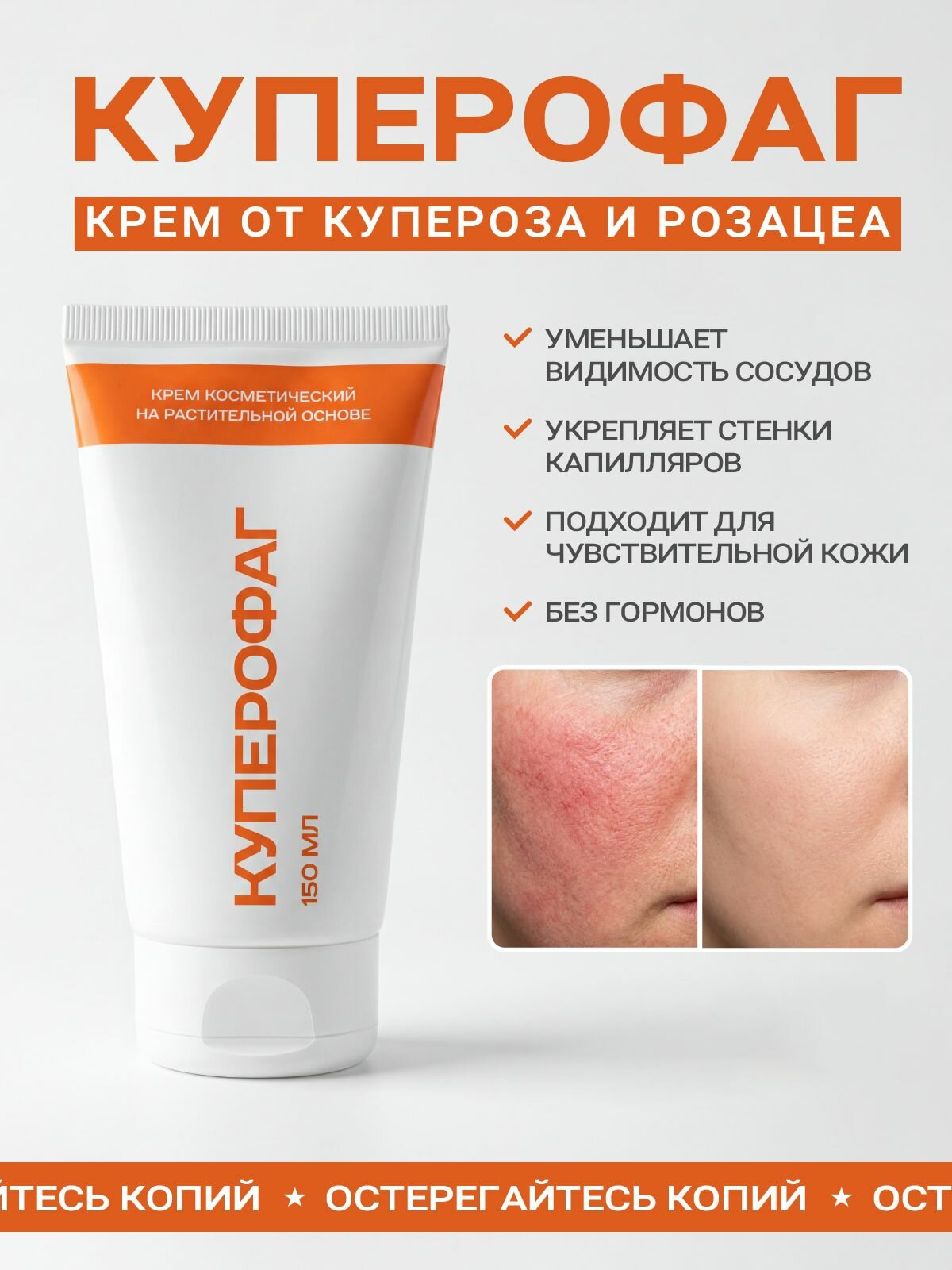 Куперофаг Крем от купероза на лице, антикупероз, средство от сосудистых звездочек, от покраснений, розацеа, успокаивающий увлажняющий крем для лица с мочевиной витамин С Е, пантенол