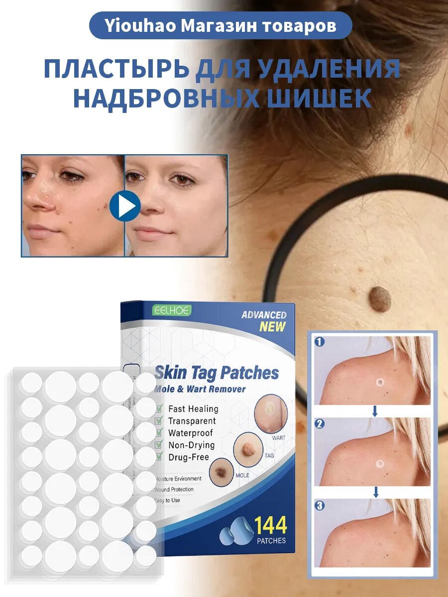 Патчи от прыщей, бородавок и от папиллом - 144 шт