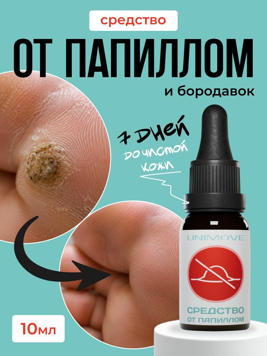 Чистотел от папиллом и бородавок, гель от папиллом, от натоптышей, от мозолей, 10 мл