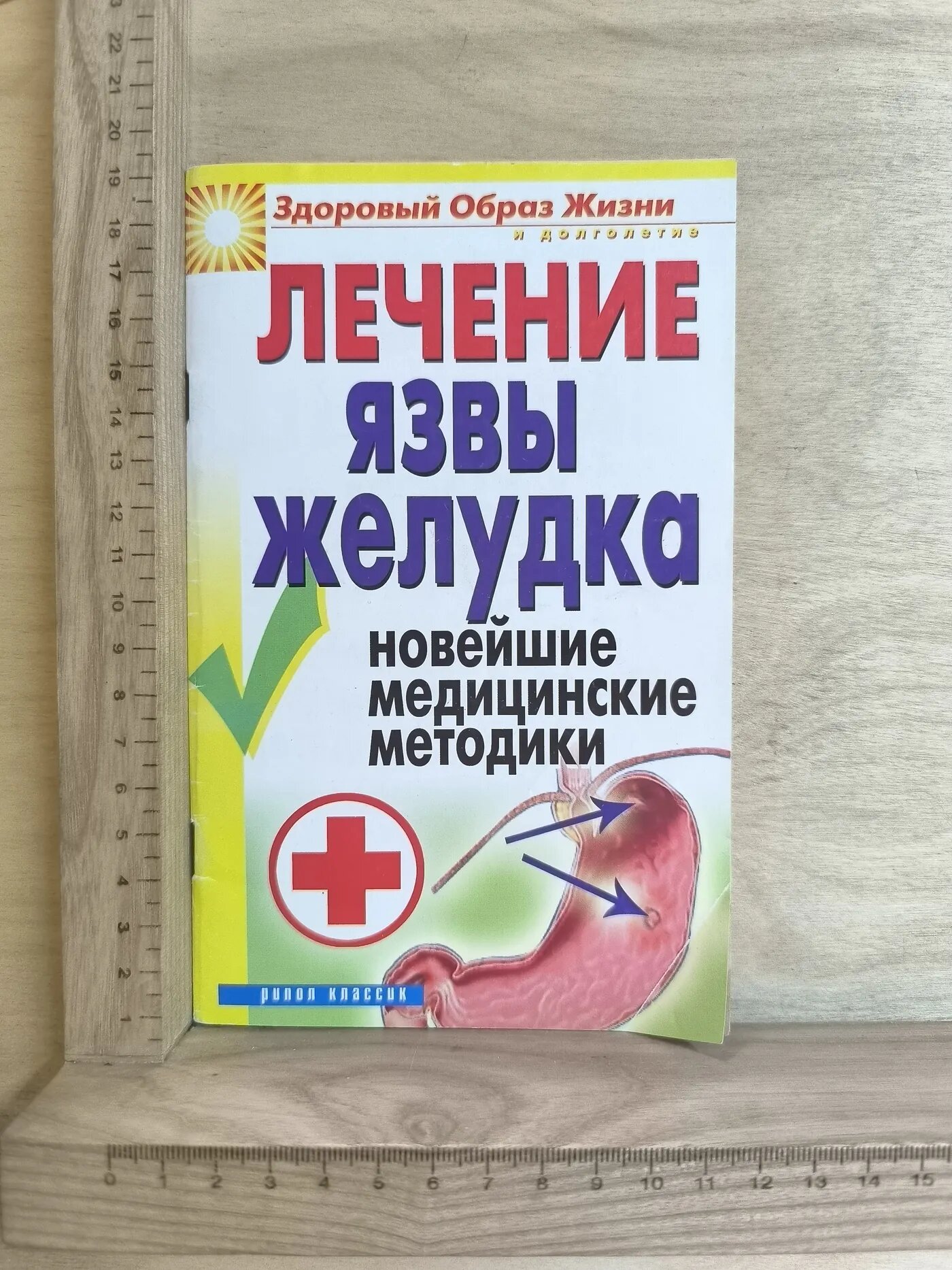 Лечение язвы желудка. Новейшие медицинские методики
