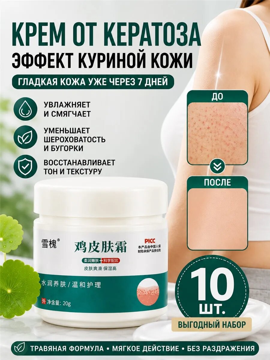 Крем для тела от гусиной кожи и сухости