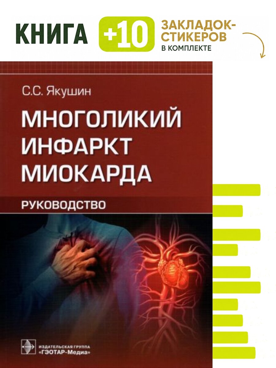 Многоликий инфаркт миокарда. Комплект: книга + 10 закладок-стикеров