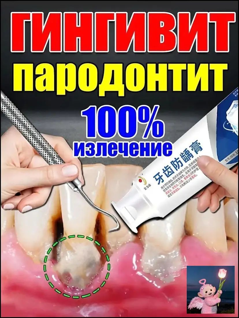 Зубная паста от пародонтита и воспаления десен, 100 мл, с фтором и диоксидом кремния, для ежедневного ухода за полостью