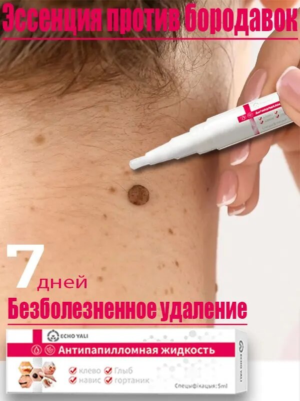 Безболезненно удаляет папилломы, родинки и подошвенные бородавки за 7 дней. Без следов и побочных эффектов. Безопасно и эффективно. Убирает дефекты кожи.