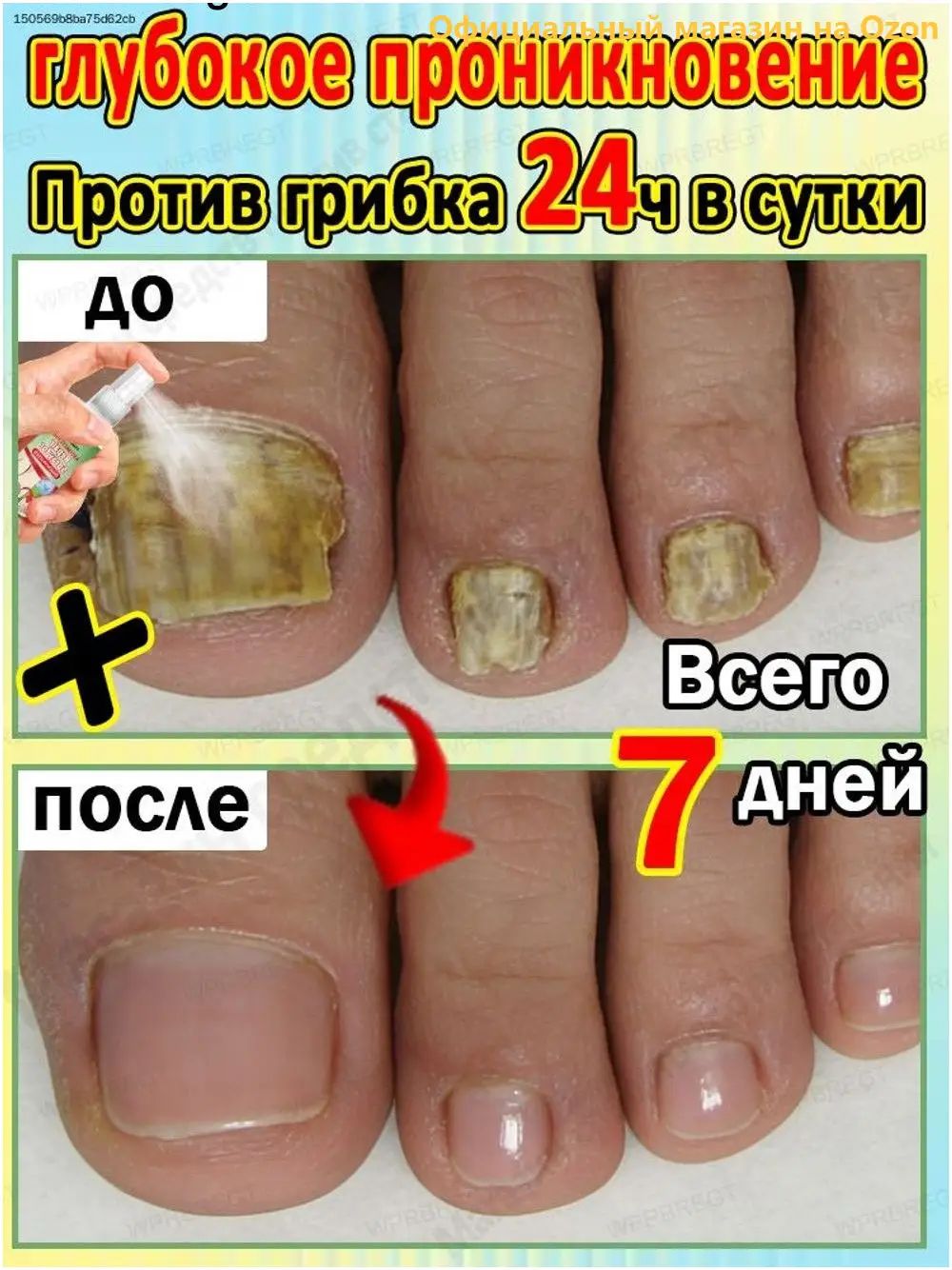 Эксклюзивный спрей против онихомикоза, ликвидирующий грибковые микроорганизмы за сутки, применяется для действенной