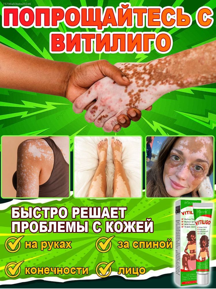 Лечебный крем, используемый для лечения витилиго и белых пятен на коже. Натуральная, не содержащая гормонов терапия, которая регулирует пигментацию и может восстановить меланин на лице и теле.
