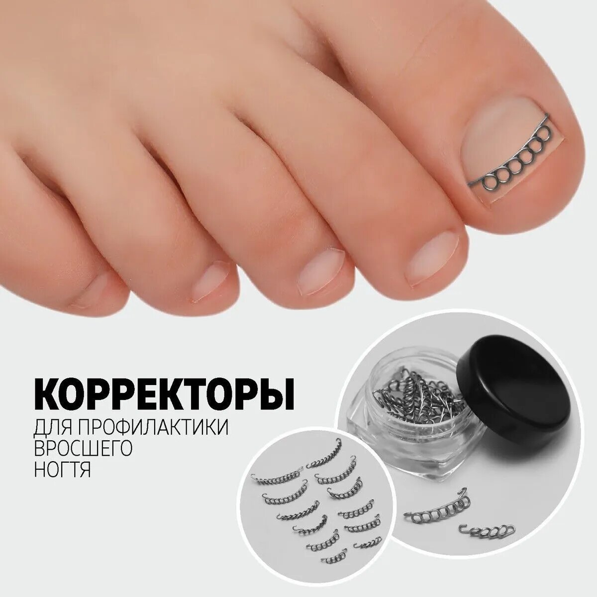 Проволочный фиксатор вросшего ногтя
