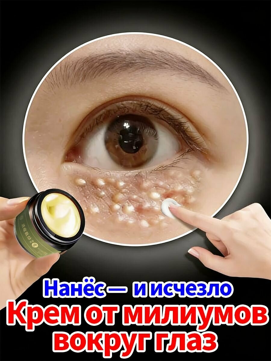 Мазь от милиумов от просянки белых угрей и роговых кист