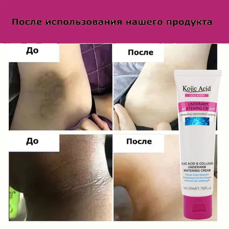Крем для отбеливания подмышек, содержащий ниацинамид, отбеливающий крем для тела, 50 мл, от пигментации в интимных зонах и зоне бикини, 50 г
