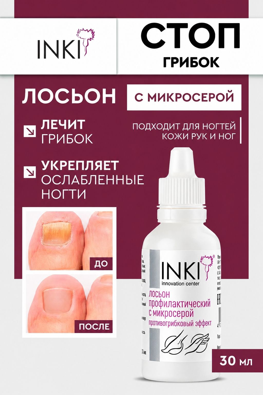 Крем лосьон от грибка ногтей на ногах и руках с серой
