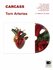 CARCASS. Torn Arteries (CD/Компакт-диск)