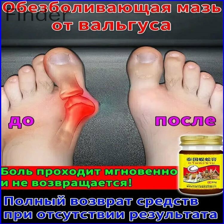 Китайская чудо мазь от вальгуса и косточки на ноге 55 г лечение вальгуса косточки на ноге
