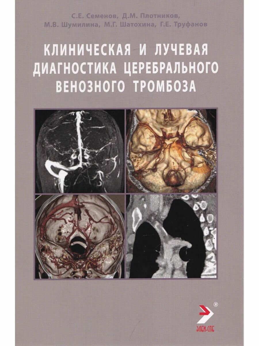 Клиническая и лучевая диагностика церберального венозного тромбоза