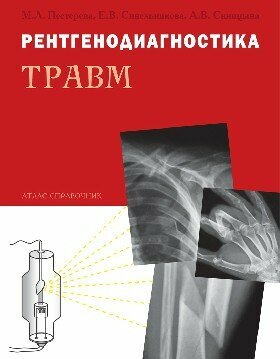 Рентгенодиагностика травм. Атлас-справочник / Пестерева М. Л, Синельникова Е. В, Синицына А. В.