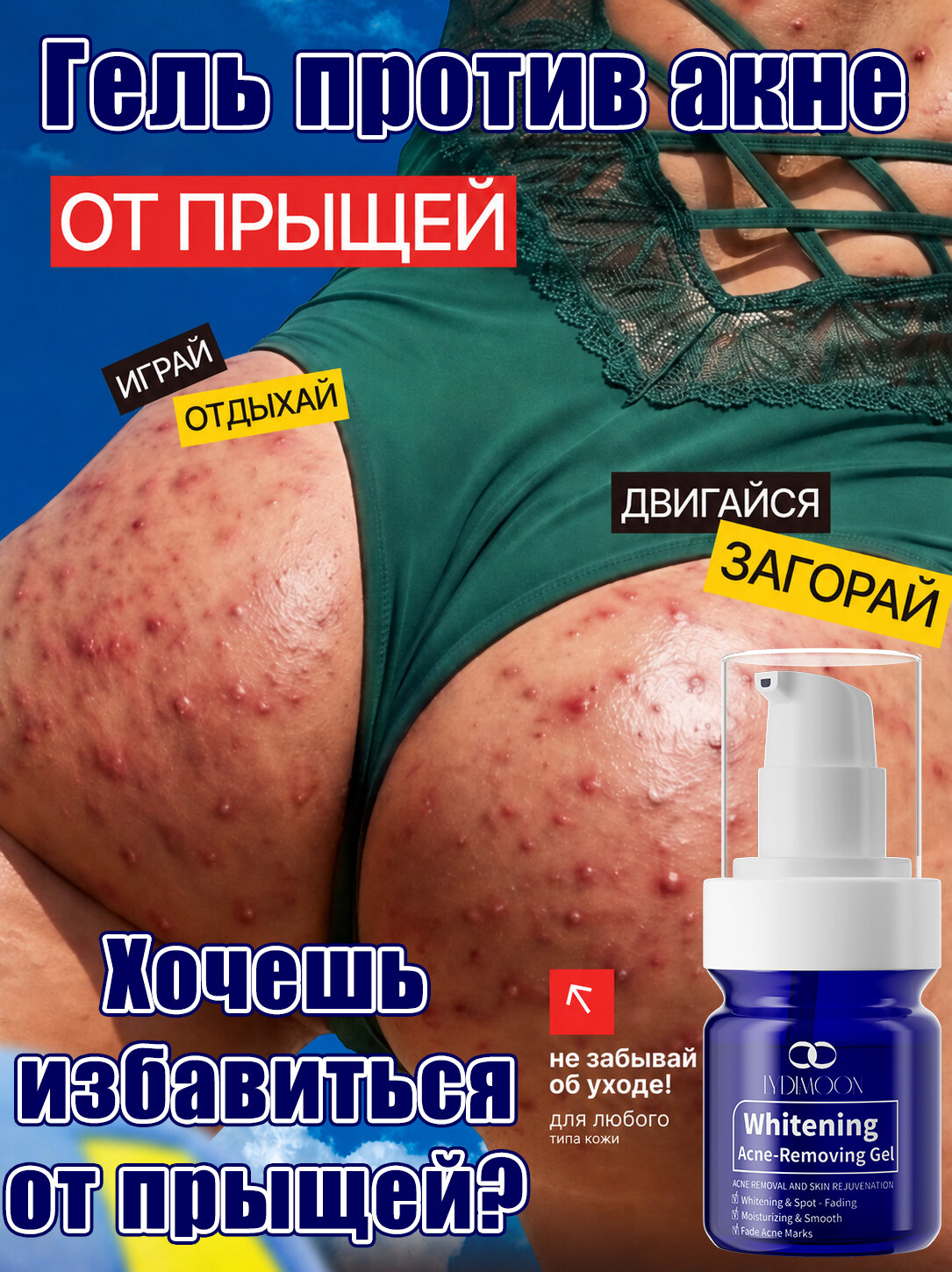 Осветляющий гель против акне и прыщей для жирной кожи лица с салициловой кислотой и ниацинамидом, 30г