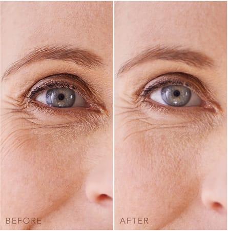 Патчи Foreo IRIS Hydrogel Eye Mask, 60 шт. — фото 1