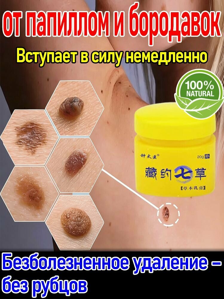 Папилофаг от папиллом