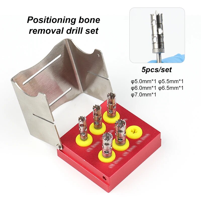 Набор трепанов VV DENTAL Positioning Removal