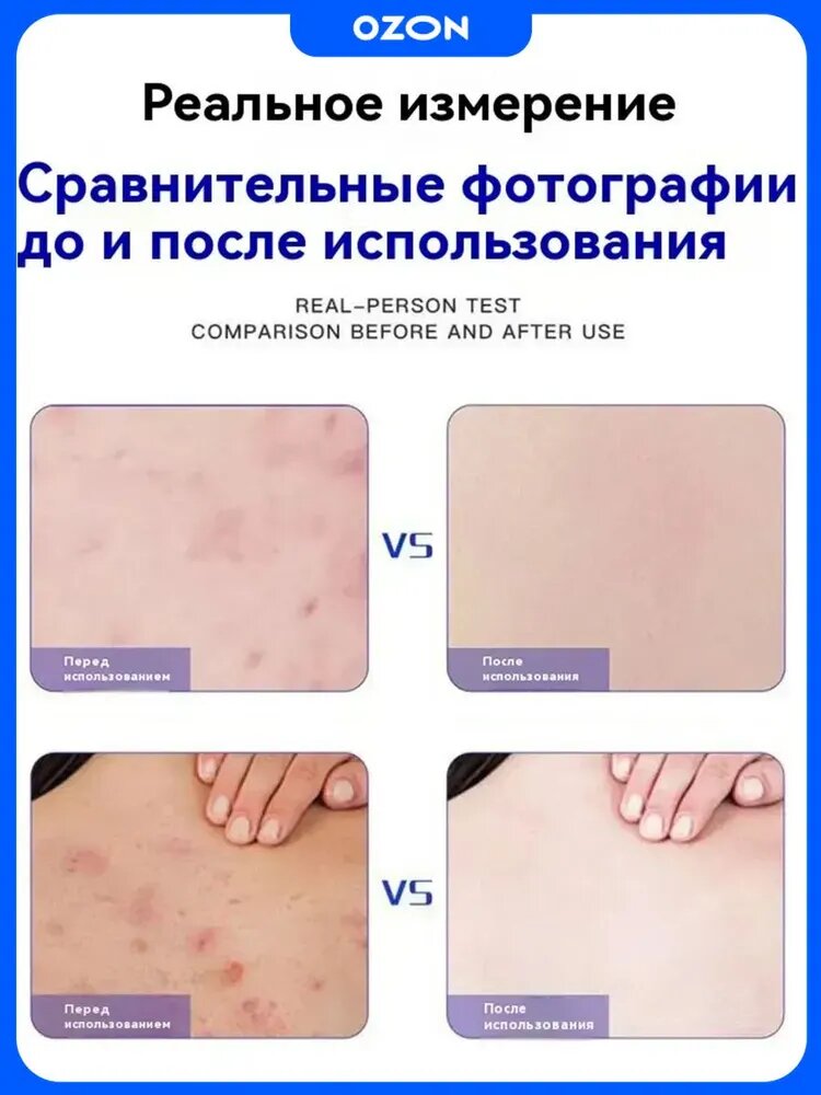 Твердое мыло — фото 1
