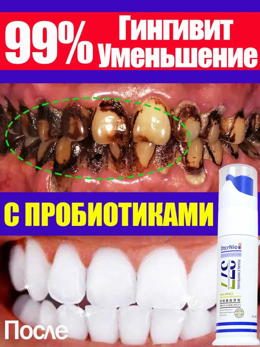 DR.SKINVITA 377 профессиональная зубная паста для отбеливания зубов, мягко отбеливает зубы, двойные пробиотики восстанавливают дёсны,120 г