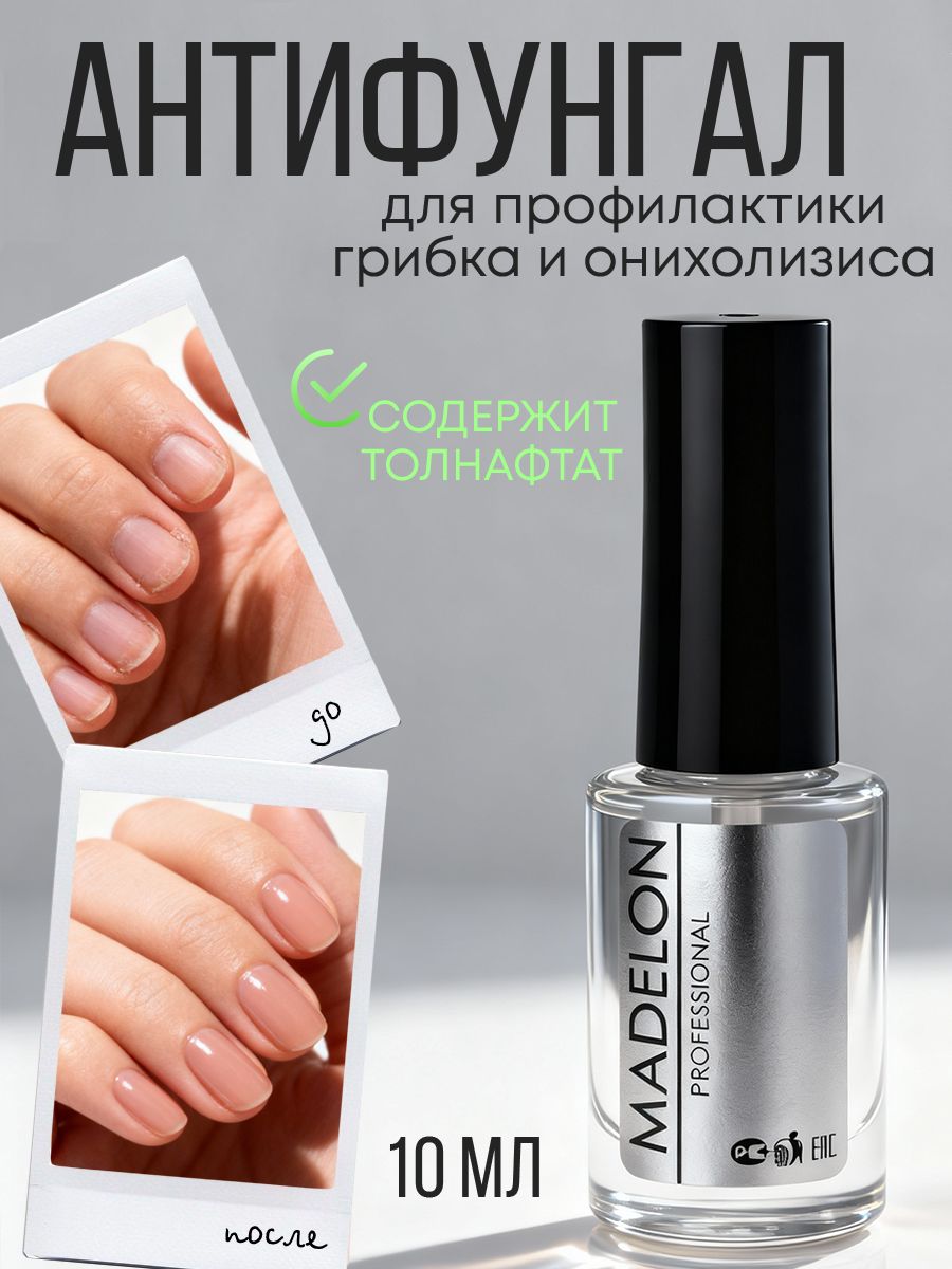 Антифунгал - стимулятор роста ногтей, профилактика грибковых заболеваний Madelon, 10 мл