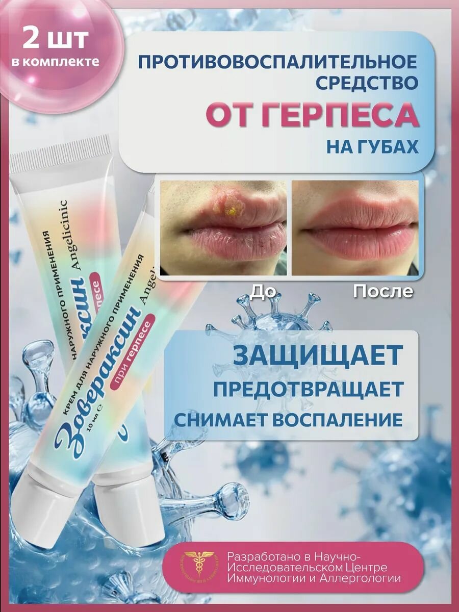Зовераксин, крем от герпеса на губах, 10 мл набор из 2х штук