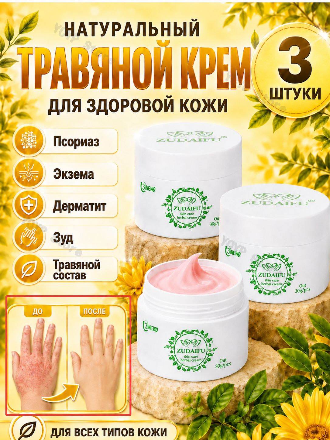 3 шт. ZUDAIFU 30 г крем для кожи головы, травяной уход при псориазе и себорейном дерматите, от зуда, сухости и шелушения, увлажняющий уход