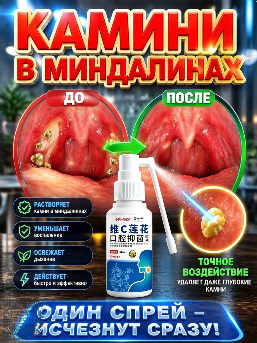 Спрей для полости рта 30 мл, Артикул: 5336547969, Спреи для полости рта