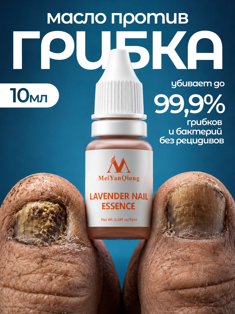 Масло для ногтей от грибка, средство для лечения грибка Nail Fungus, 10 мл, лечение онихолизиса