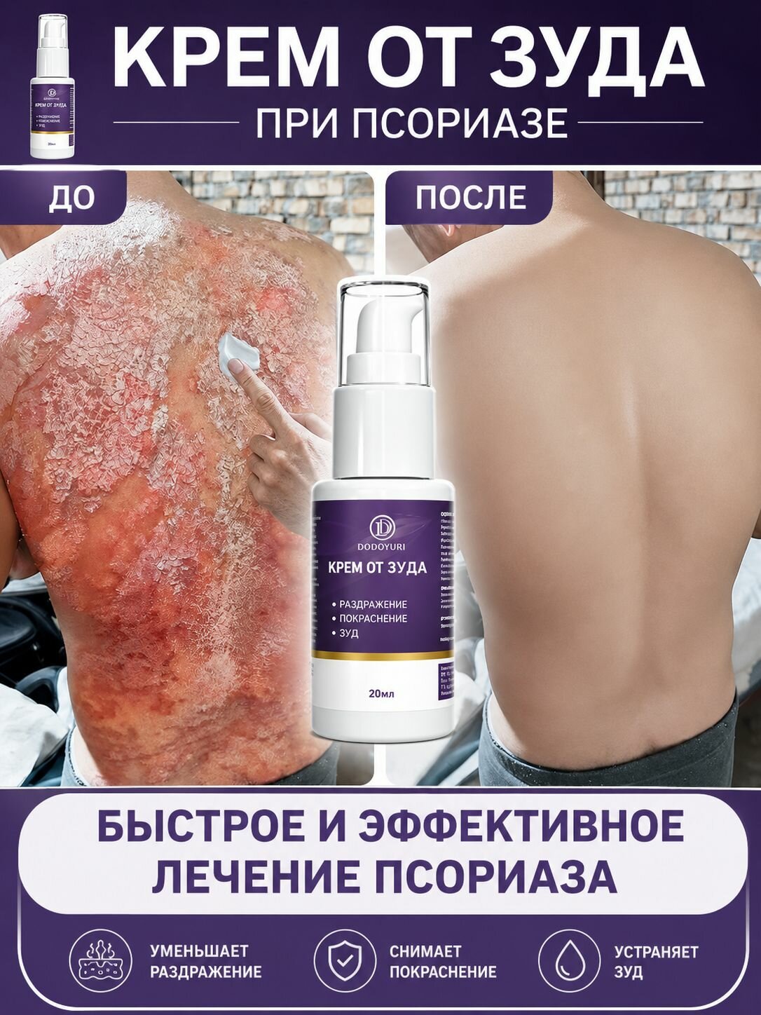 DODOYURI Антипсориаз / Крем мазь негормональный от псориаза, экземы, нейродермита, грибковых заболеваний, дерматита, себореи 20 мл.