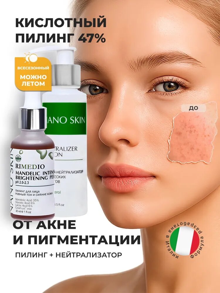 Кислотный пилинг для лица с миндальной кислотой профессиональный химический Nano Skin Mandelic Intenso, Пилинг + нейтрализатор100+30 мл