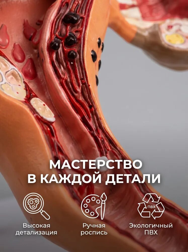 Макет Органы матки, патологии 24х12х20см / 9278899