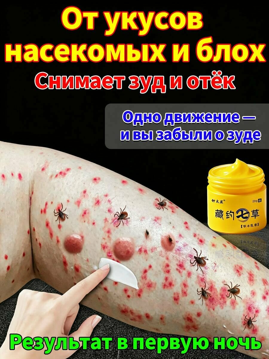 Мазь после укусов комаров снимает зуд