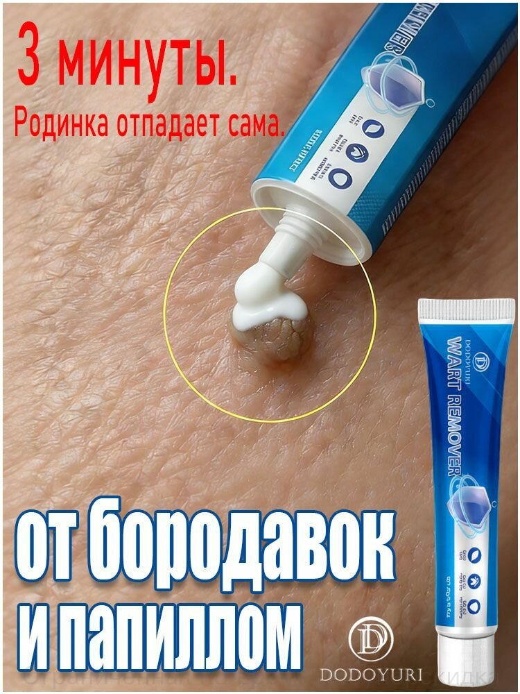 Эксклюзивный крем для устранения бородавок, папиллом и родинок, обеспечивающий безболезненное удаление без рубцов и побочных реакций, 20 г бородавки папилломы родинки от бородавок папиллом родинок удаление папиллом