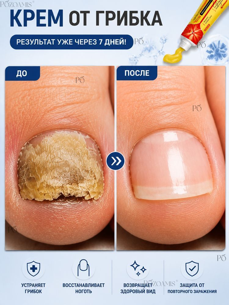 Желтая мазь подходит для лечения пожелтения, онихомикоза, боковой грибковой инфекции, выпадения ногтей и других симптомов. /30 мл/бутылка